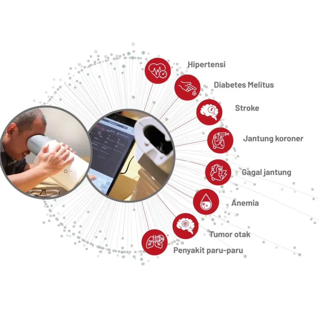 Fast and Accurate Eye Exams with Airdoc